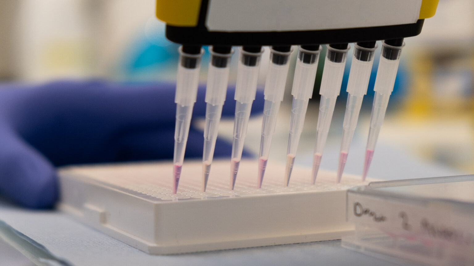 Functional Effect Of PDL1 Blockade On A Cell-Based Assay - Explicyte ...