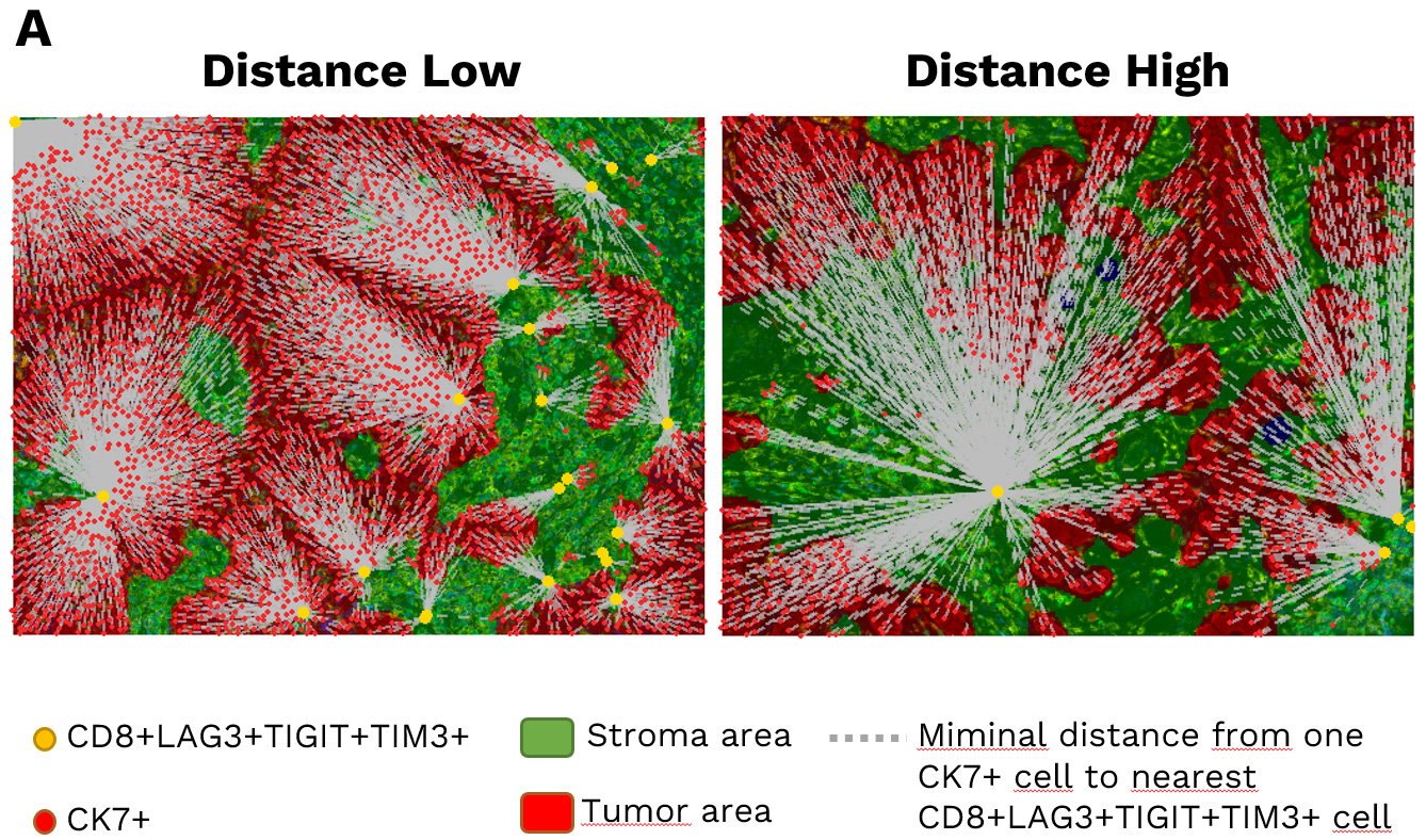 Digital pathology services I Immuno-Oncology CRO I Quantitative ...