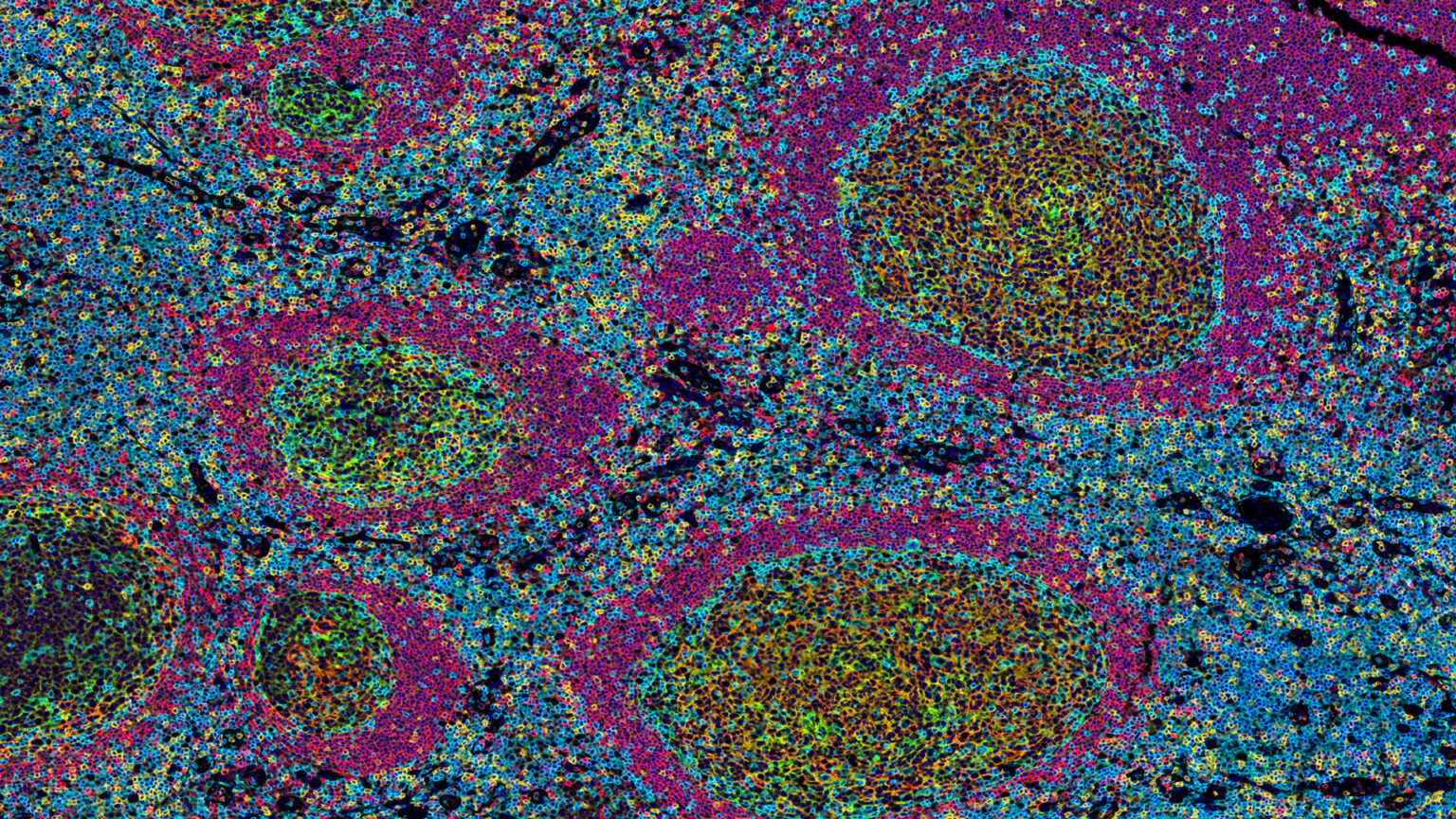 Translational research in cancer immunotherapy: 5 key findings ...