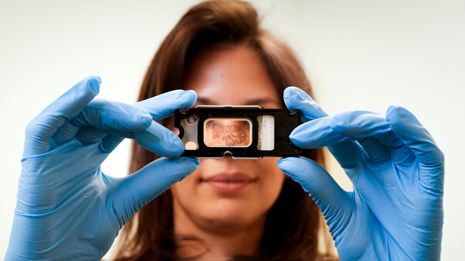 Cure51 Partners with Explicyte for Spatial Analysis of Exceptional ...